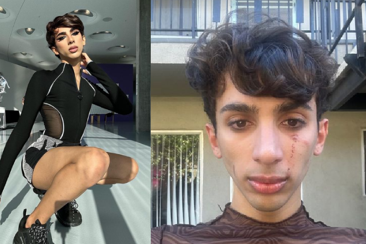 Alex Dimension denuncia que lo agredieron en Los Ángeles | Critica